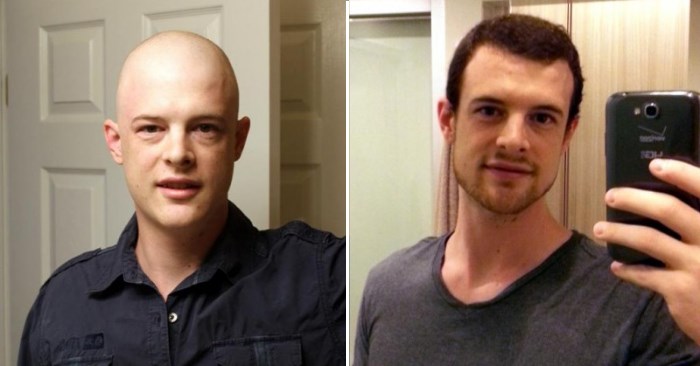 14 inspirerende før- og etterbilder av mennesker som viser oss at det ...